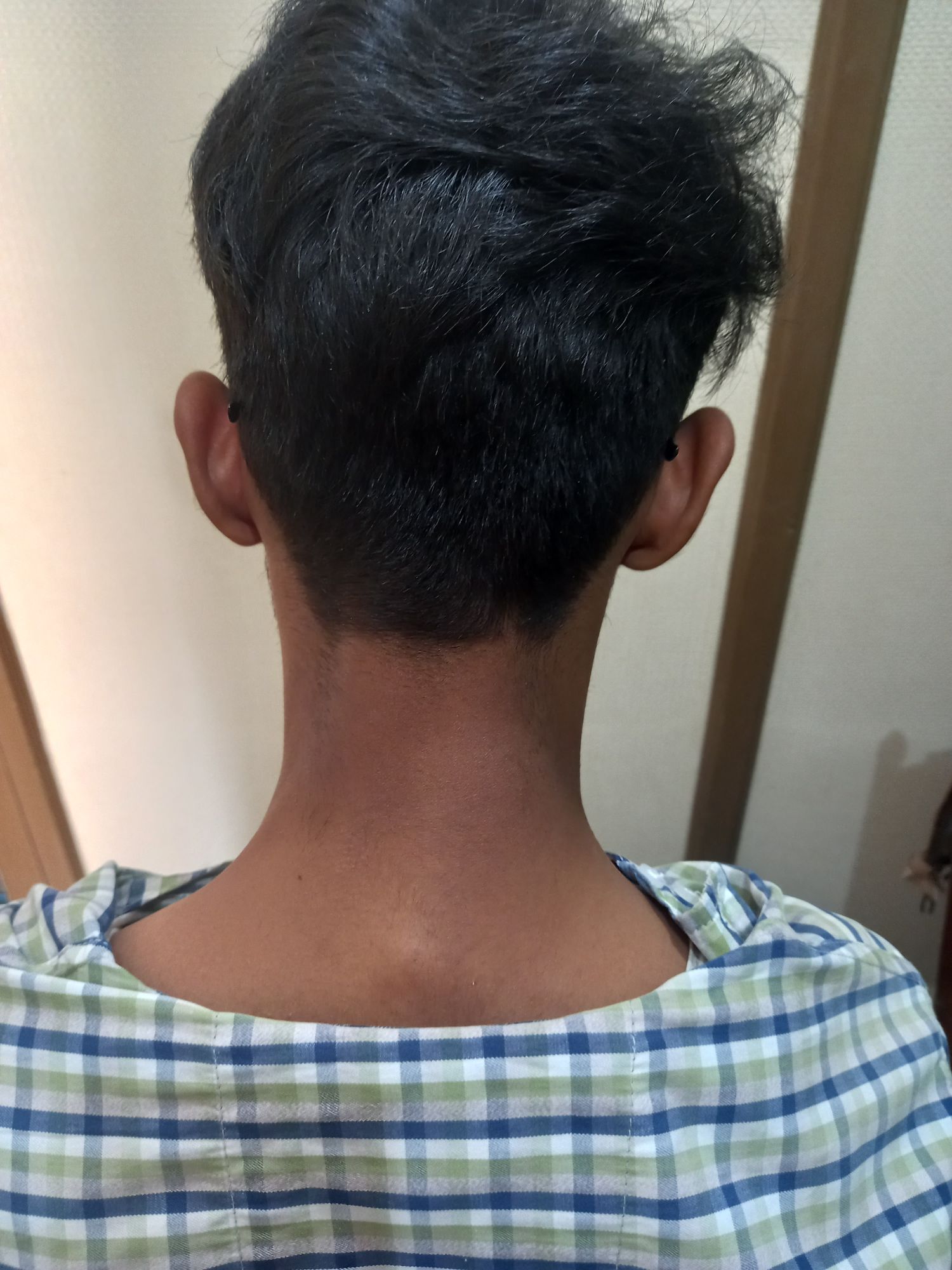 Cervical Spondylosis Physiotherapy